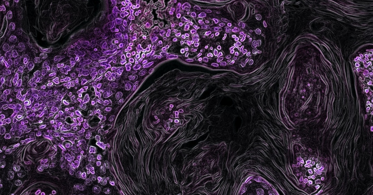 Plasma Cosmology and the Electric Universe Theory
